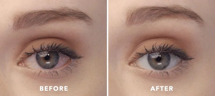 Ocufresh – Ocufresh – Health & Medical